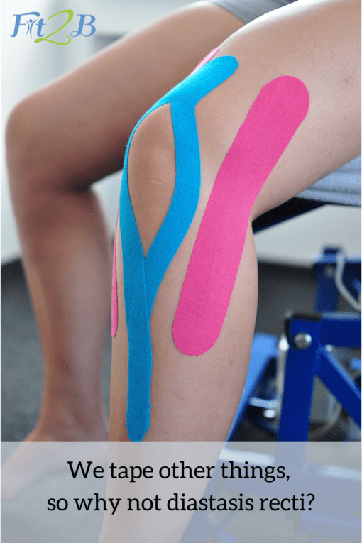 Taping Diastasis Recti: How to Use Kinesiology Tape on Separated Abs ...